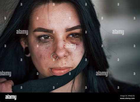 Portrait Of Beaten Young Woman In Black Protective Mask With Bruise