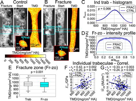 Tissue Mineral Density Tmd Distribution Of Individual Trabeculae For