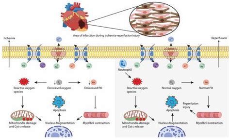 Ala Alkhader On Linkedin The Use Of Cardioprotective Devices And