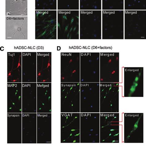 Traumatic Brain Injury Tbi Mouse Model For Tracing The Download