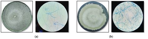 macro and micromorphological characteristics of endophytic fungi from
