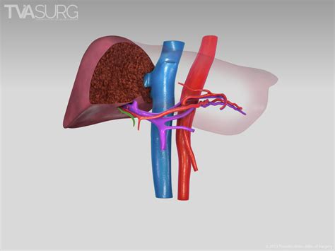 Extended Left Hepatectomy Pkvisualization Surgery