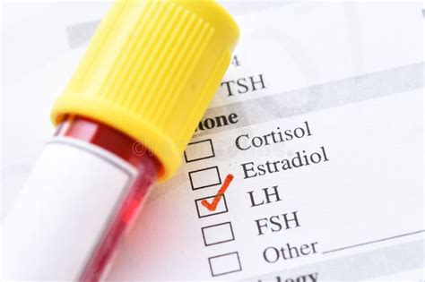 Luteinizing Hormone Test Stock Image Image Of Hormone 115314617