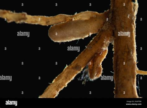 Clover Root Nodule Light Micrograph Stock Photo Alamy