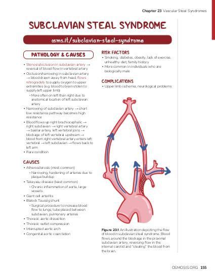 Subclavian Steal Syndrome Video Causes And Meaning Osmosis