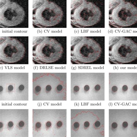 segmentation results of images with intensity inhomogeneity download