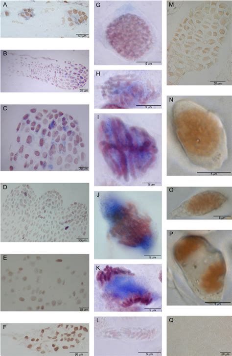 The Localization Of Adc And Odc Mrnas And Adc Enzyme In Developing