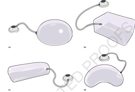 5 Variation In Shape Of Tissue Expanders A Spherical B