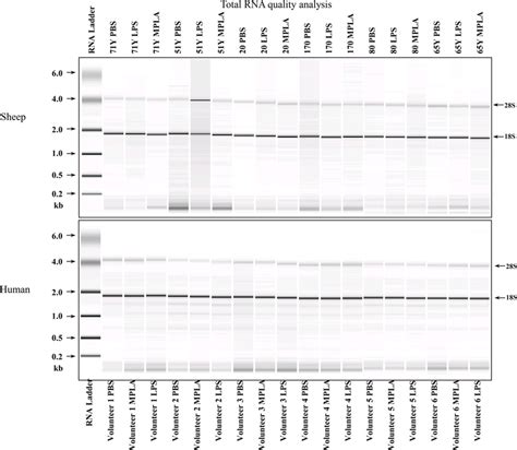 Total Rna Quality Analysis Quality Of The Purified Rna Was Assessed By