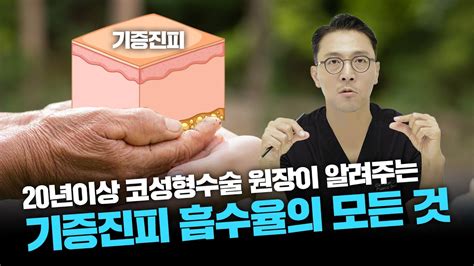 215화 20년이상 코성형수술원장이 알려주는 기증진피 흡수율의 모든 것 Youtube