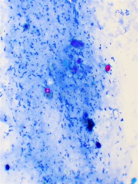 Cryptosporidium Parvum Microscope