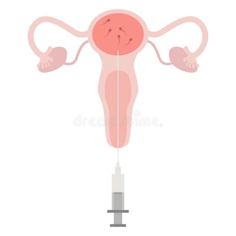 Egg Cell Insemination Stock Illustrations 3038 Egg Cell Insemination
