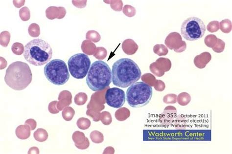 Pin On Hemato Hematology Blood Cells Cell