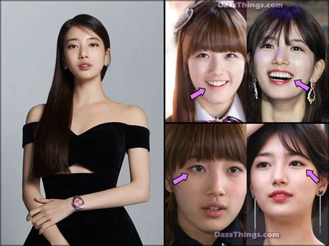 Bae Suzy Plastic Surgery Comparison Photos