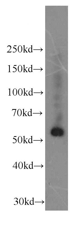 Fibrinogen Gamma Chain Mouse Monoclonal Antibody