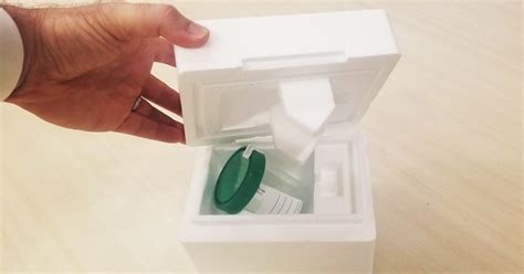 Columbia S At Home Sperm Collection Kit Makes Tests Easier