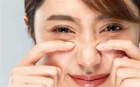 Blackhead Vs Whitehead Whats The Difference Florida Independent