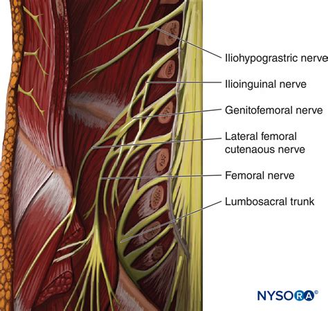 Regionalanästhesie Psoas Muskel Freigelegt Aus Der Bauchhöhle Mit Lumbalen Plexus Ästen Nysora