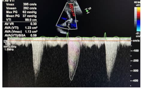 Chapter 11 ECHO Flashcards Quizlet