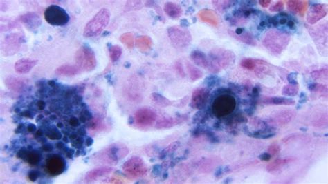 Scientists Use Nanotechnology To Detect Bone Healing Stem Cells Orthofeed