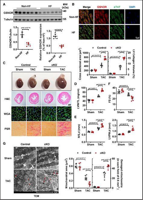 Figure 1 From Mitochondrial Gsnor Alleviates Cardiac Dysfunction Via