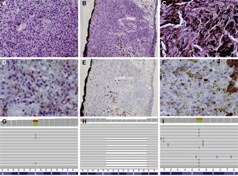 Histopathologic Features And Next Generation Sequencing Ngs Results Download Scientific