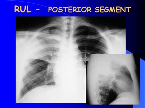 Md Giuliano Marcelli Ucsc Ppt Download Md Giuliano Marcelli Ucsc Ppt Download