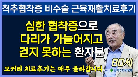 척추관협착증 비수술 치료후기 심한 협착증으로 다리가 가늘어지고 걷지 못하는 환자 재활치료후기 1편 Youtube