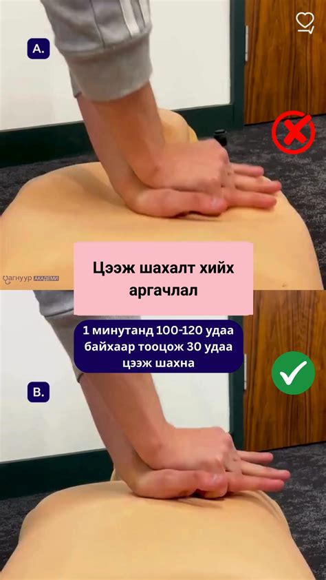 🔵🔴🟡⚪️ Яаралтай тусламжийн эрэмбэлэн ангилалт 2021 оны шинэчилсэн ЭМЯ