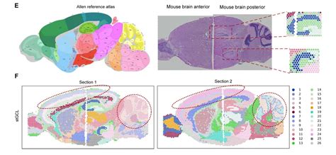 空间转录组多样本niche的比较分析（visium And Xenium And Hd）niche生态位空间转录组 Csdn博客