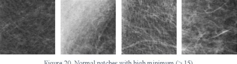 Figure 1 From Interpretability Approaches For A Breast Lesion Detection Model Semantic Scholar