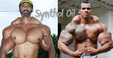 Synthol Chest Injections