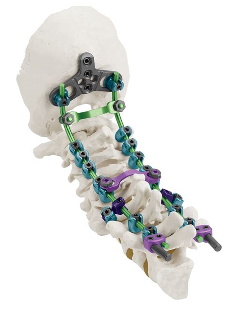 Globus Medical Quartex™ Occipito Cervico Thoracic Spinal System