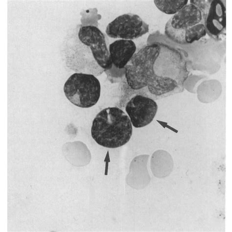Pdf Hematogones In The Bone Marrow Of Adults Immunophenotypic Features Clinical Settings