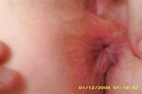 Asshole And Hairy Pussy Mound Of Friends Wife Porn Pictures Xxx