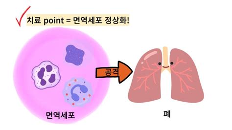 간질성폐질환 폐섬유증 치료 시 꼭 알아야하는 내용들feat 실제 환자 사례 네이버 블로그