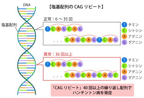 ハンチントン病 はんちんとんびょう とは 済生会