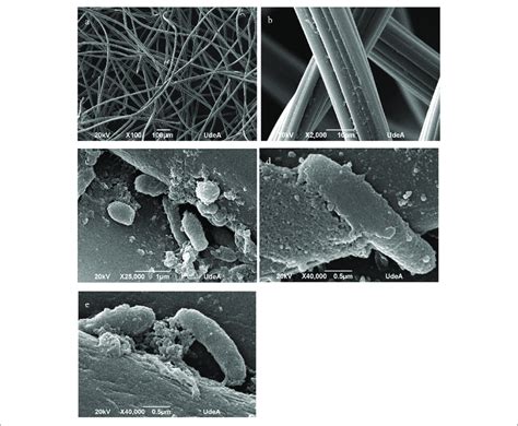 Analysis By Scanning Electron Microscopy Of The Anode Of Mfc1 The