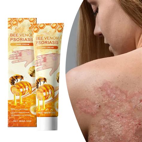 Lyzmus Reduced Personal Skin Care Care Deeply Nourishes And Redness And