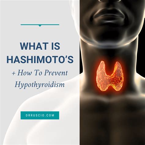 What Is Hashimotos How To Prevent Hypothyroidism Dr Michael Ruscio Dc