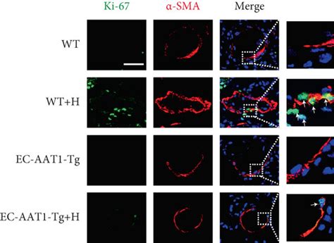 Increased Ec Derived So2 Ameliorates Hypoxia Induced Paec Inflammation