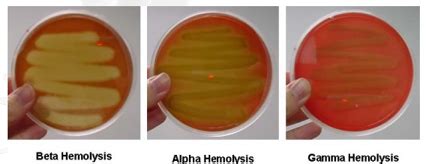 Identification Of Streptococcus Flashcards Quizlet