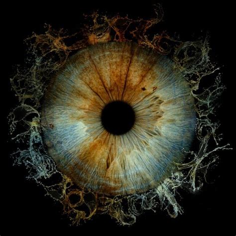 Cataract And Refractive Institute Of Florida On Linkedin Learn More