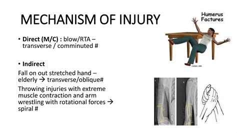 Fracture Of Humerus Shaft And Intercondylar Fracture Pdf
