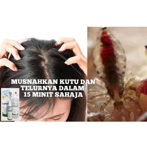 HEAD LICE SPRAY SPRAY KUTU KEPALA Shopee Malaysia