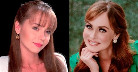 Gaby Spanic aseguró que no se ha realizado cirugías en el rostro pero sí este procedimiento