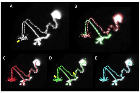 An Example Of Segmentation Of A Neuron With Several Arborizations Download Scientific Diagram