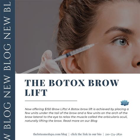 Botox Brow Lift…say The Lotus Aesthetics And Wellness Facebook
