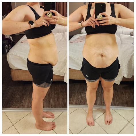 Rather Tmi Question Re Lesbian Sex And Loose Skin Post Tt R