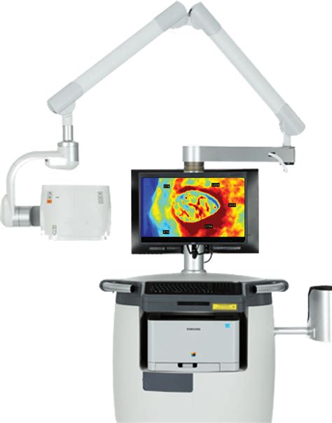 Perfusion Imaging System Syncro Medical